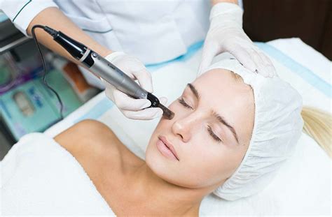 كيفية استخدام جهاز ديرما بن في 4 خطوات أكاديمية Challenge