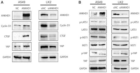 Ankhd1 Promotes Proliferation And Invasion Of Non‑small‑cell Lung Cancer Cells Via Regulating