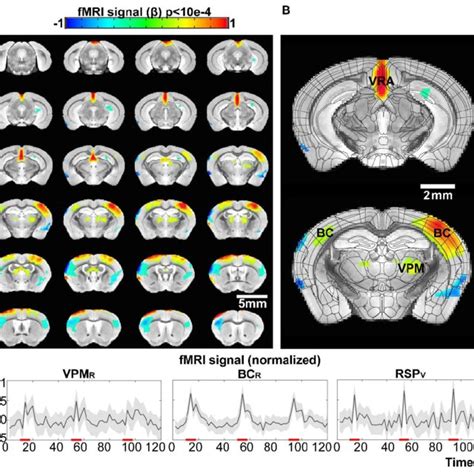 Visual Stimulation Evoked High Resolution Fmri Of Awake Mice A The Download Scientific