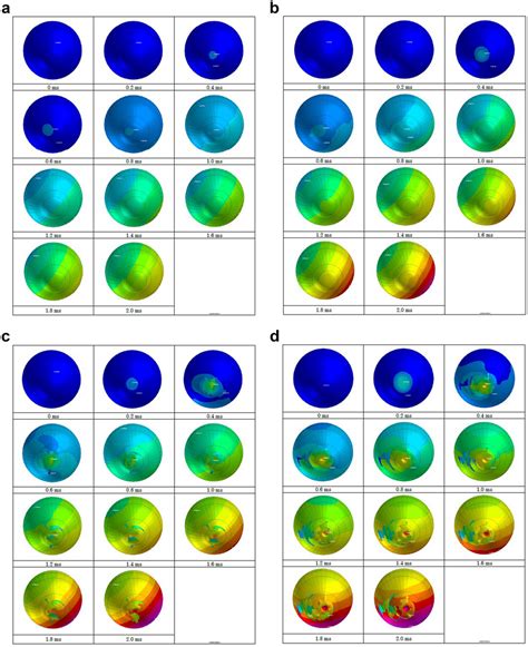 Sequential Deformity Of Long Axial Length Myopic Model Eye Upon Download Scientific Diagram