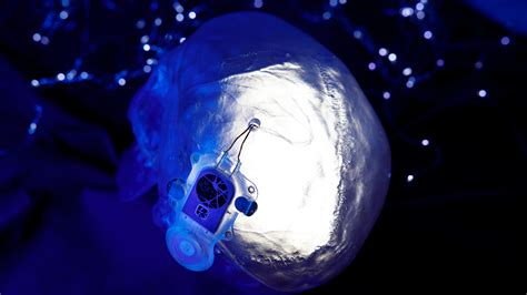 consortium to develop fully implantable brain computer interface to