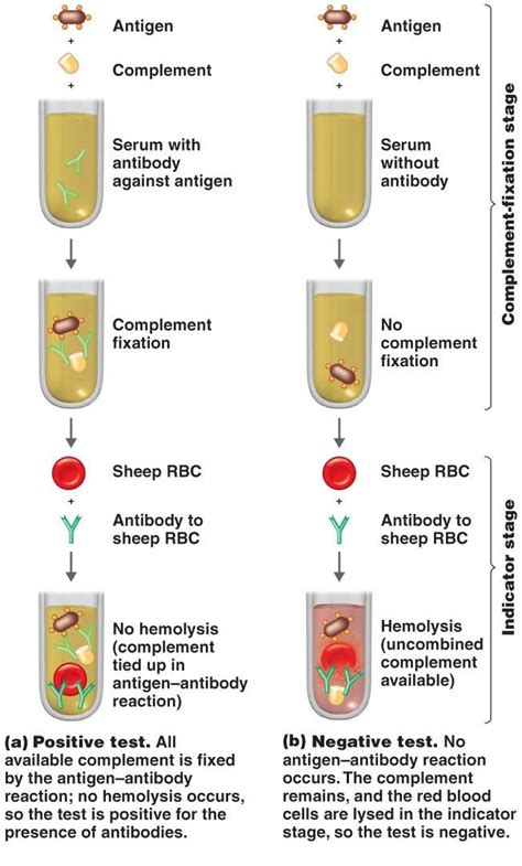 Complement Fixation Test Detecting Specific Antibodies