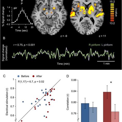Un Sensed Unilateral Intranasal Electrical Stimulation Reduced Download Scientific Diagram
