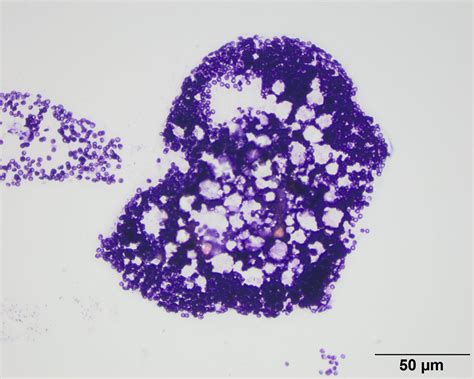 Artifacts Cytology Eclinpath