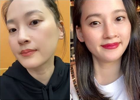 모델 혜박 점 수술 후 더 예뻐진 미모 왜 이제야 했을까 후회 [n샷] 헉스