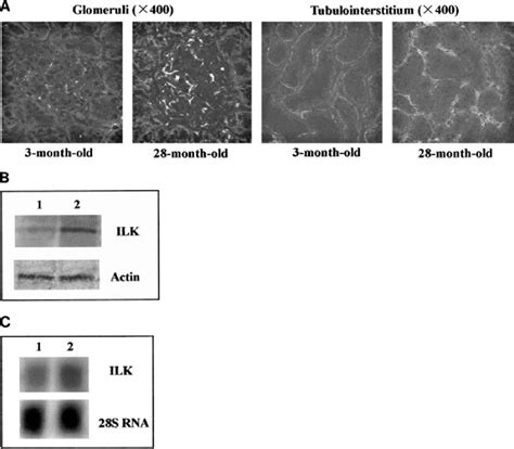 Expression Of Integrin Linked Kinase Ilk In Young And Aging Normal Download Scientific