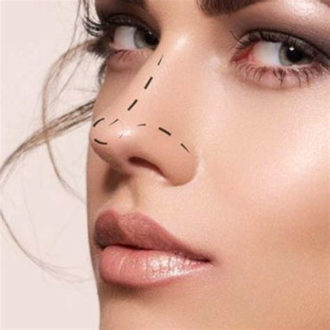 რინოპლასტიკა ბათუმში Sagittarius Clinic