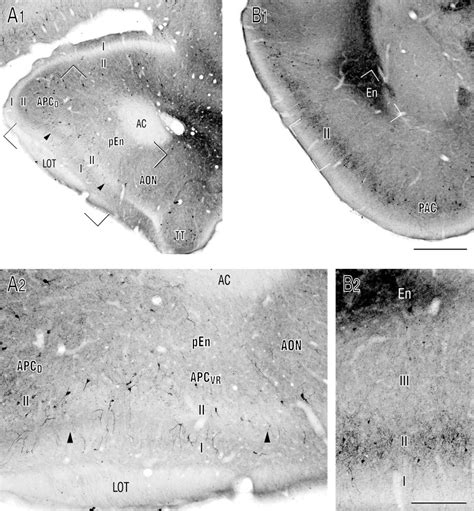 Piriform Cortex Anatomy