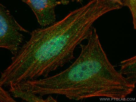 Ubiquitin Antibody 80992 1 Pbs Proteintech