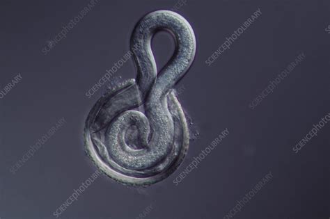 Dog Roundworm Hatching Light Micrograph Stock Image C0115123