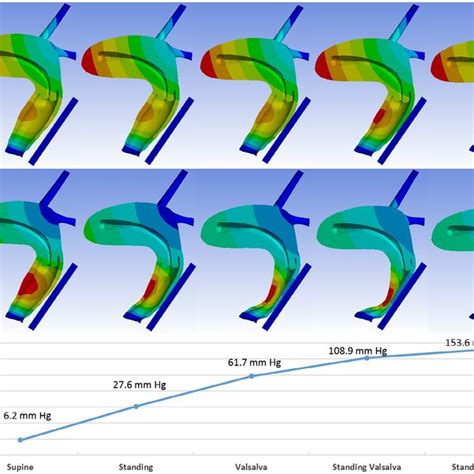 Pdf 3d Finite Element Modeling Of Pelvic Organ Prolapse