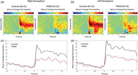 Upper Plots Ab Group‐averaged Time‐frequency Plots Are Shown For Download Scientific