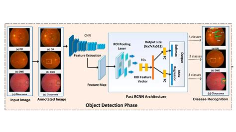Use Of Artificial Intelligence Drmata System For The Detection And