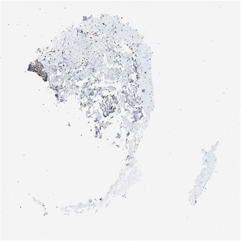 Tissue Expression Of Cebpb Staining In Skin The Human Protein Atlas