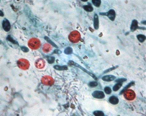 Cryptosporidium Spp Mont Medi