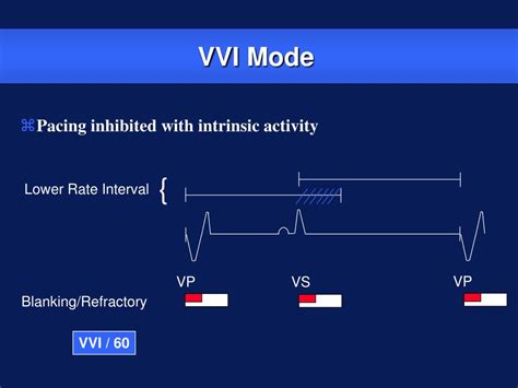 Ppt Pacemaker Timing Part I Powerpoint Presentation Free Download