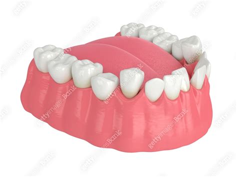 3d Render Of Jaw With Abnormal Teeth Position 이미지 1272723650 일러스트 무료