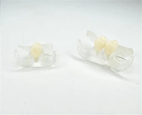 Dental Supply Fabricate Clear Dentures Removable Flexible Partial