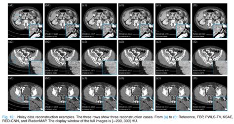 Radon Inversion Via Deep Learningfbp算法和iradon Csdn博客
