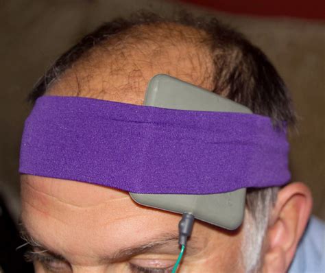 Left Dlpfc Diy Tdcs