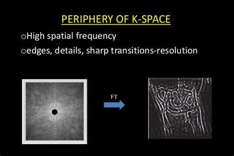 K Space And Parallel Imaging