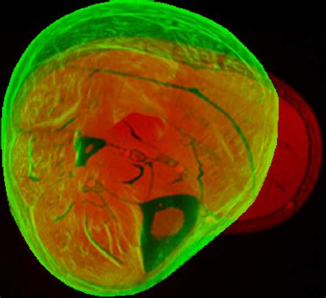 Rigid Body Registration Of Both Modalities Us And Mri Download Scientific Diagram