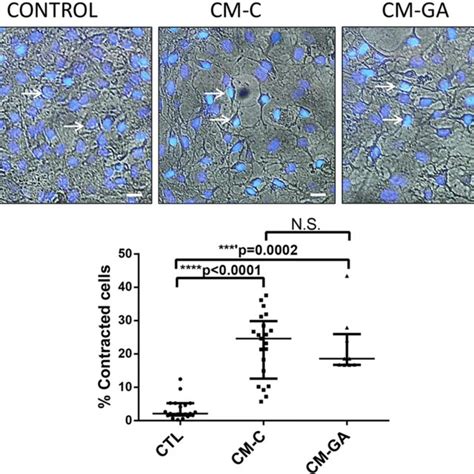 Astrocyte Conditioned Media Induces Pericyte Contractility In Cell Download Scientific Diagram