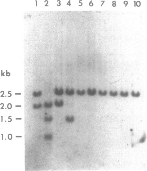 Southern Analysis Of Recombinants Recovered In The Presence Of 2mm Download Scientific Diagram