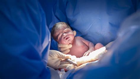 Pela 1ª Vez Bebê Nasce Através De Fertilização In Vitro Automatizada