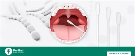 Does A Throat Culture Only Test For Strep