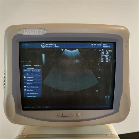Sell Ultrasound Machine Ge Logiq 7 Germany Bimedis United Kingdom