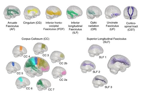 Representation Of The Major Bundle Models Used By Recobundlesx As Shape Download Scientific