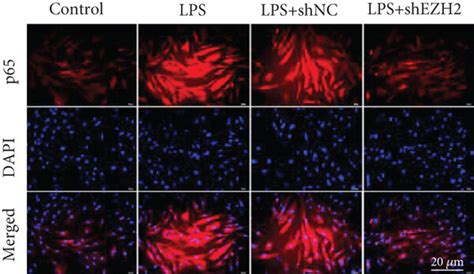 Ezh2 Knockdown Inhibits Tlr4myd88nf κb Signaling To Facilitate Pdlsc