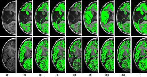 4 Examples Of Segmentation Accuracy Of Multiple Segmentation Methods