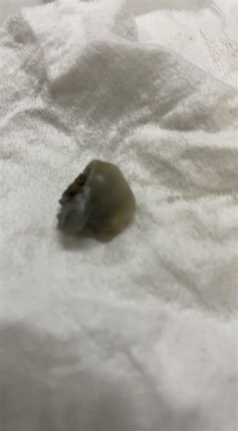 Found Tooth Inside Home R Inlandempire