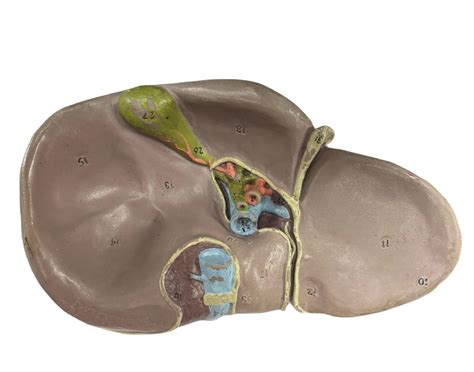 Liver Lab Model Quiz