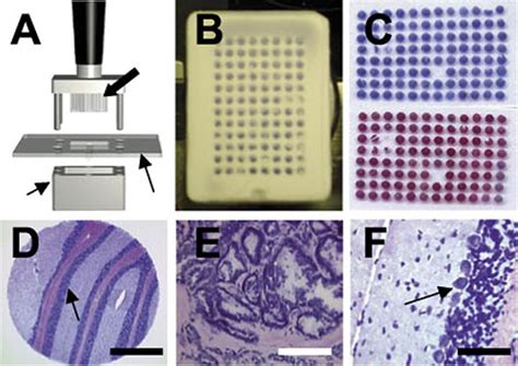 Full Article New Tissue Microarray Technology For Analyses Of Gene