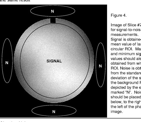 Figure 4 From Overview Of The Acr Mri Accreditation Phantom Semantic Scholar