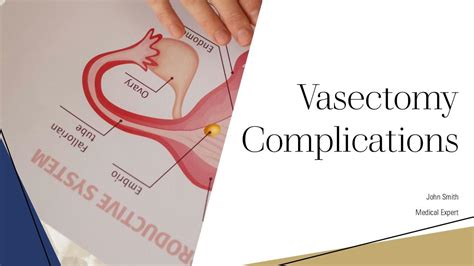 Vasectomy Complications Ppt Slides Acp Ppt Example