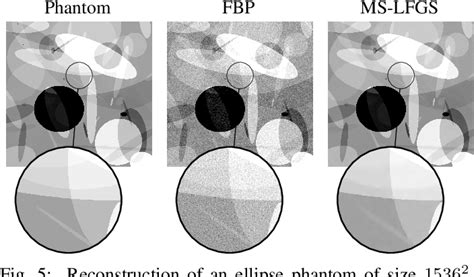 Figure 1 From Multi Scale Learned Iterative Reconstruction Semantic Scholar