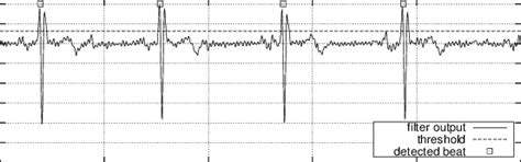 Peak Algorithm A Beat Is Detected If The Window Maximum Is Also The Download Scientific