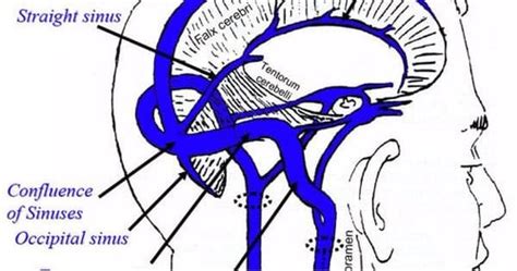 Confluence Of Sinuses Skull