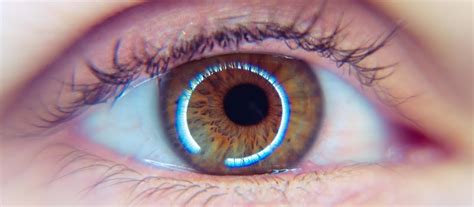 Qual A Melhor Cirurgia Para Tratar O Glaucoma