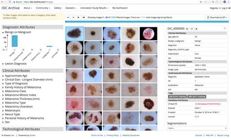 A Gentle Introduction To Machine Learning — Classification Of Malignant