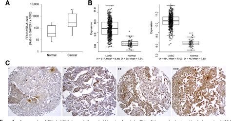 Tumorigenesis And Neoplastic Progression Overexpression Of Flap
