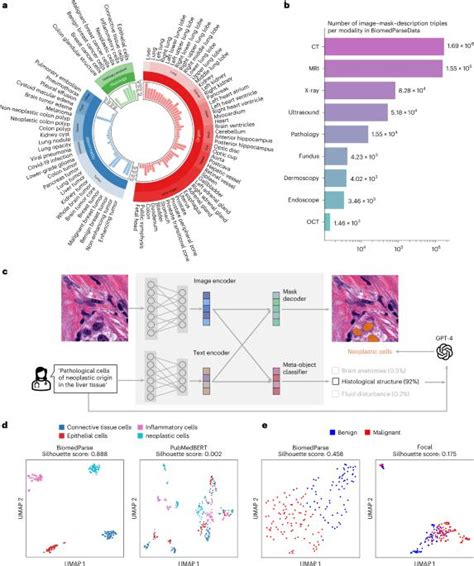 Doug Burger On Linkedin A Foundation Model For Joint Segmentation Detection And Recognition Of