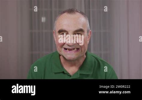 Smile Young Man Missing Teeth Stock Videos And Footage Hd And 4k Video