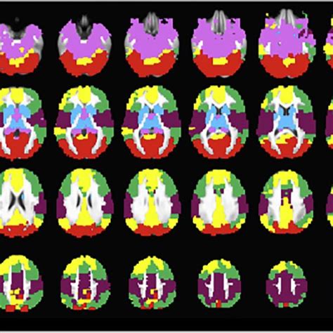 Graphical Depiction Of The Group Level Large Scale Modular Brain Download Scientific Diagram