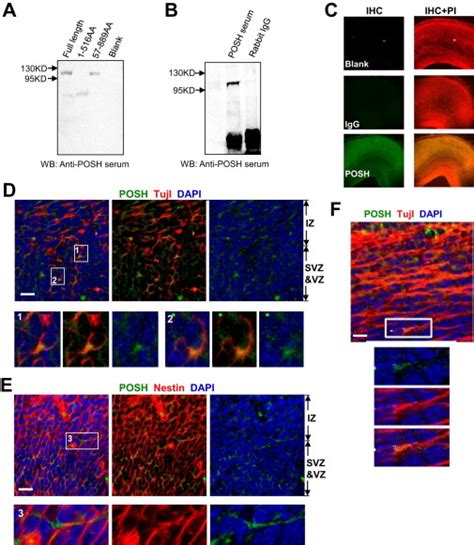 Posh Expression In The Neocortex Related To Figure 1 Download Scientific Diagram
