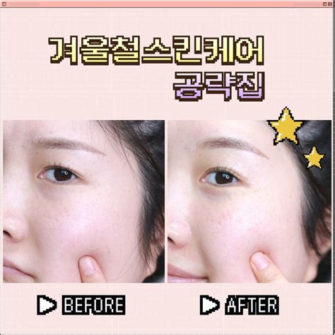 소르릉 광고 💧 피부의 근본을 탄탄하게 마녀공장 비피다 바이옴 앰플 💧 피부 장벽 강화와 슬로우 에이징을 위한 최고의 선택 요즘같이 자외선이 강한 계절에도 피부를